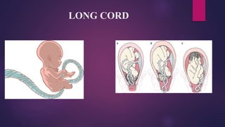 Placental and cord abnormalities | PPTX