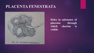Placenta Fenestrata