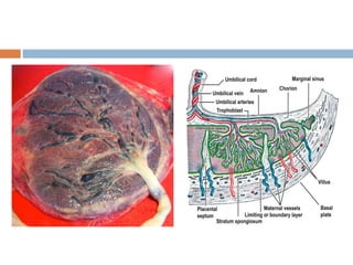 Placental disorders | PPT