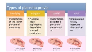 Placental Factors.pptx