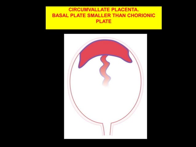 Placental grading | PPTX | Pregnancy | Reproductive Health