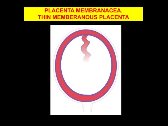 Placental grading | PPTX | Pregnancy | Reproductive Health