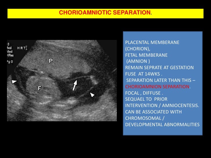 Placental grading
