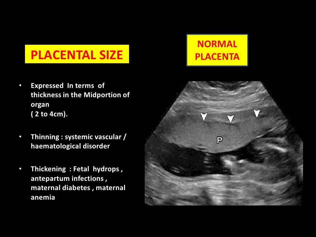 Placental grading
