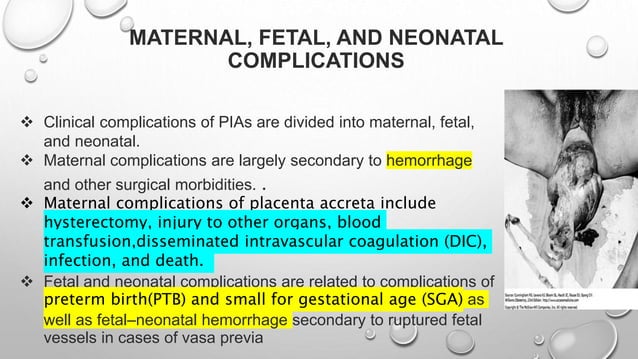Placental implantation abnormalities | PPTX | Pregnancy | Reproductive ...