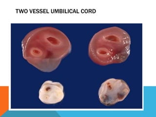 Placental pathology | PPTX
