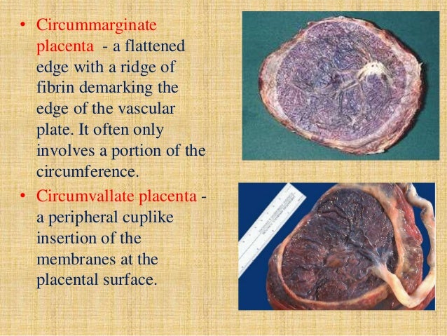 Placental pathology