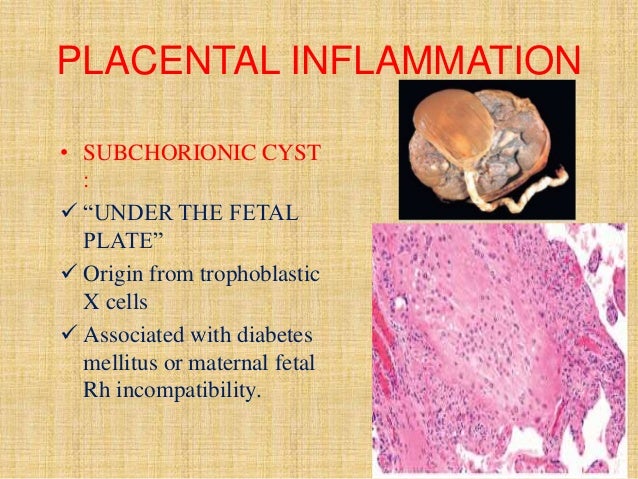 Placental pathology