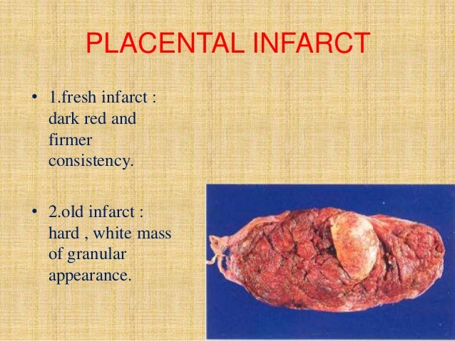 Placental pathology