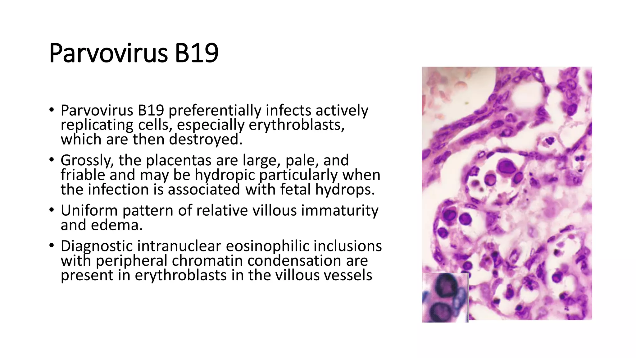 placenta pathology | PDF
