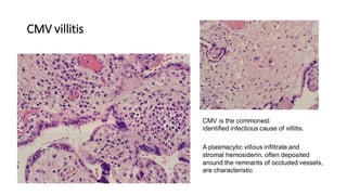 placenta pathology | PDF