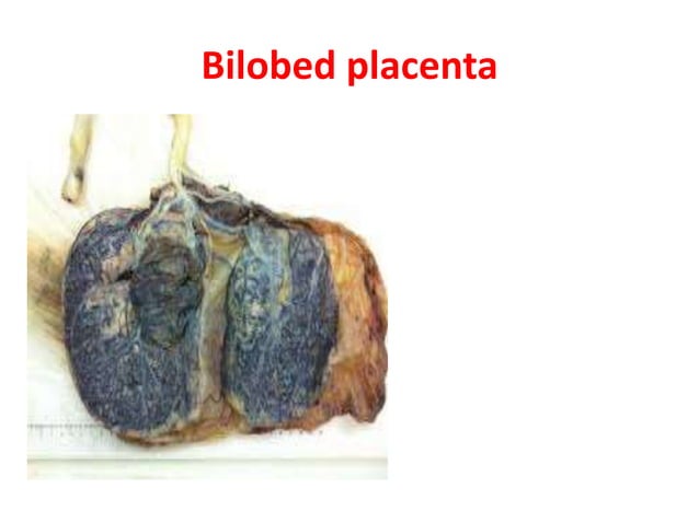 placenta ppt.pptx OBSTETRICS and gynaecologist | PPT