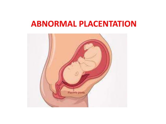 placenta ppt.pptx OBSTETRICS and gynaecologist | PPT