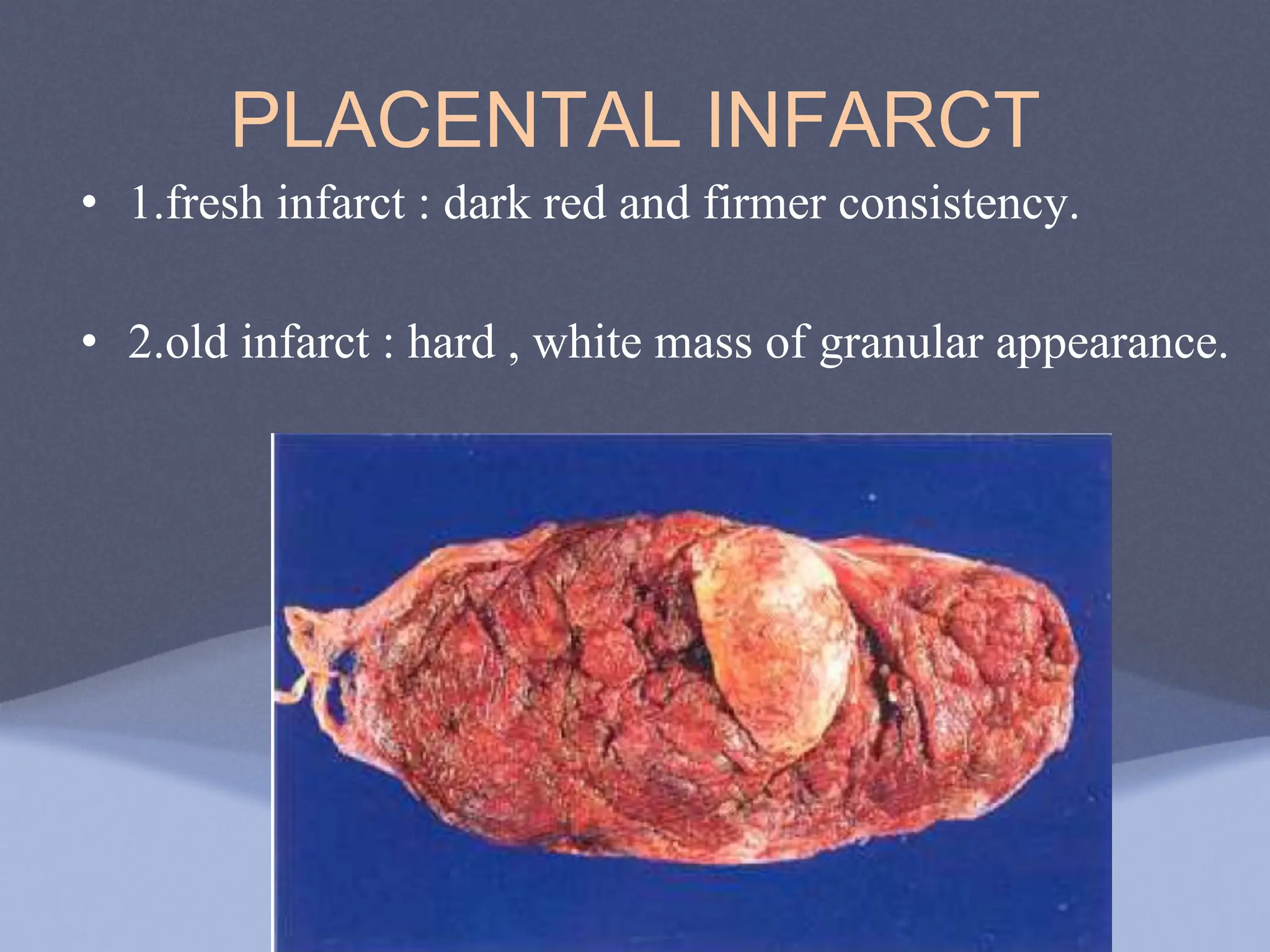 placenta grossing and it’s pathologies .pdf