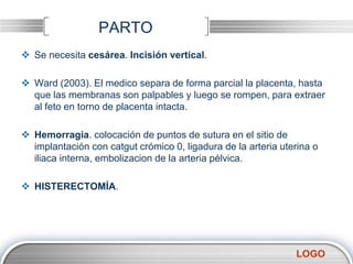 Placenta previa | PPTX