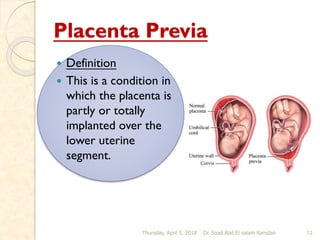 Placenta previa | PDF