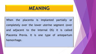 Placenta previa | PPTX