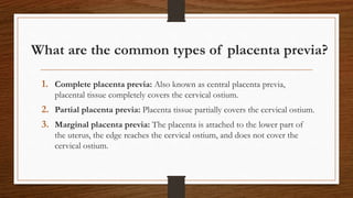 Placenta previa | PPTX