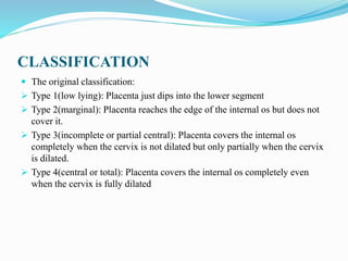 Placenta previa | PPTX