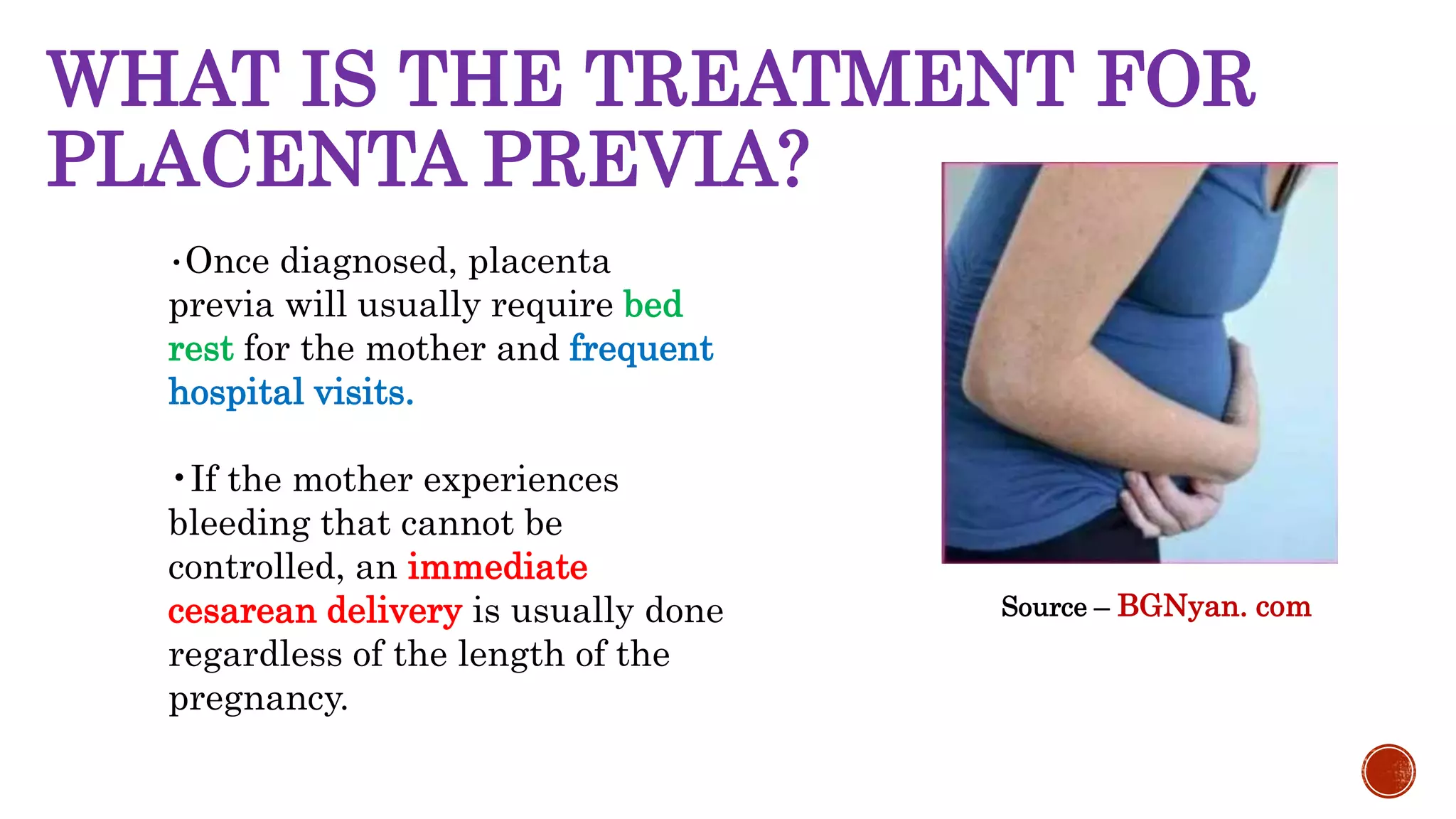Placenta previa presentation by YML | PPTX