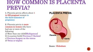 Placenta previa presentation by YML | PPTX