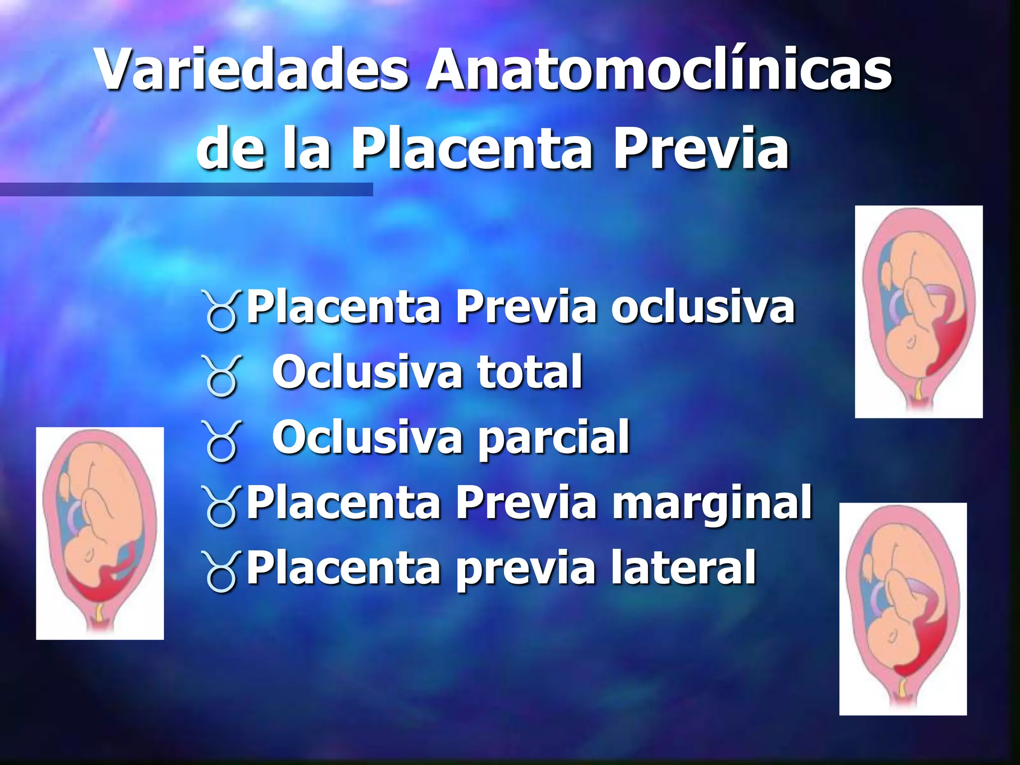 placenta previa.ppt