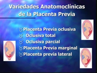 placenta previa.ppt