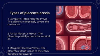 Placenta PreviaDEFINATION INCIDENCE RISK FACTOR AND COMPLICATION | PPT