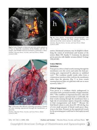 Placenta previa, accreta, etc | PDF