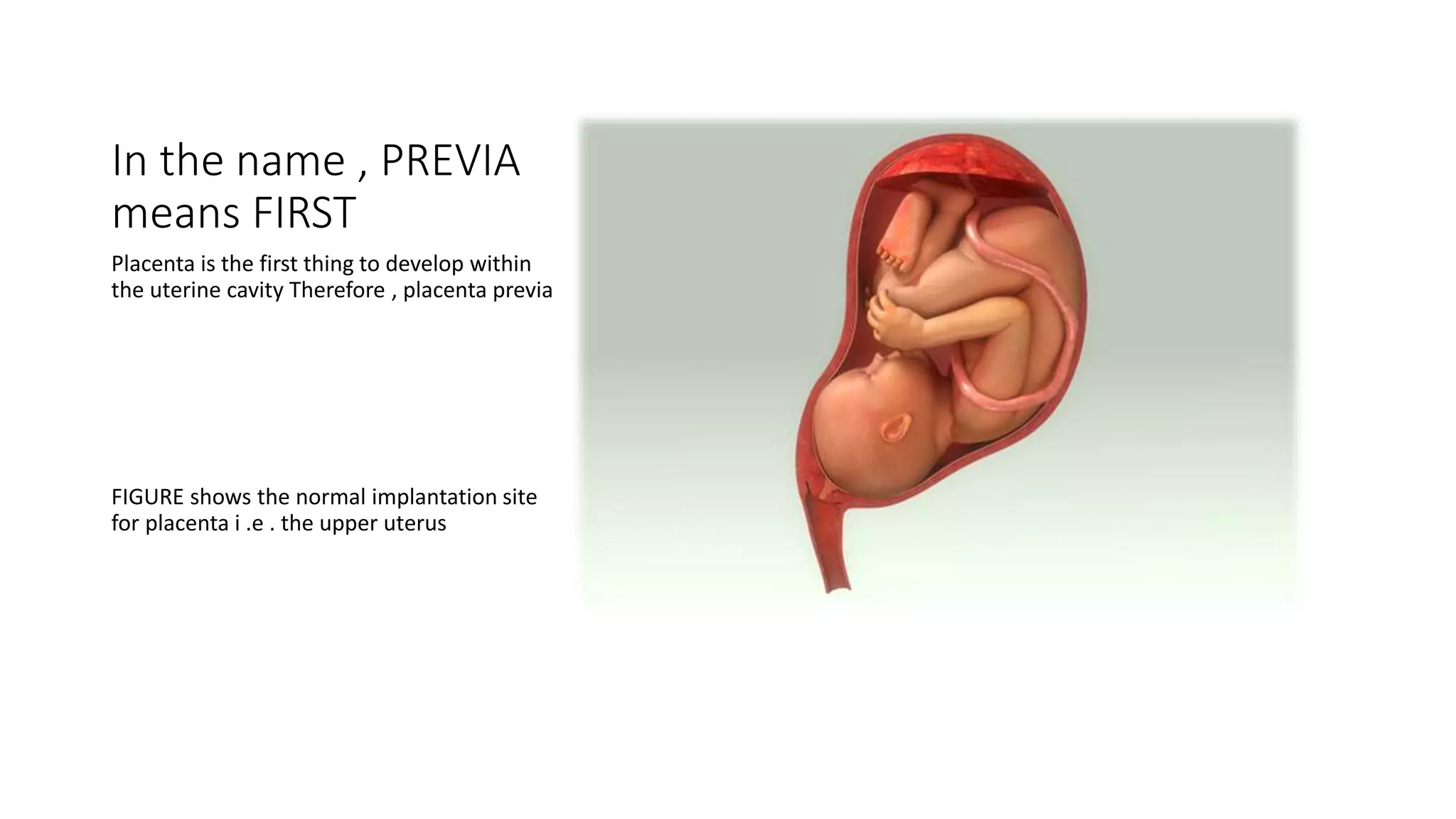 Placenta previa and discharge of patients after c section | PPTX