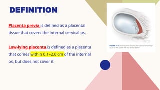 Rangkuman Placenta Previa pada kehamilan .pptx