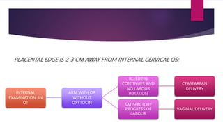 PLACENTA PREVIA REMASTERED Presentation[1].pptx