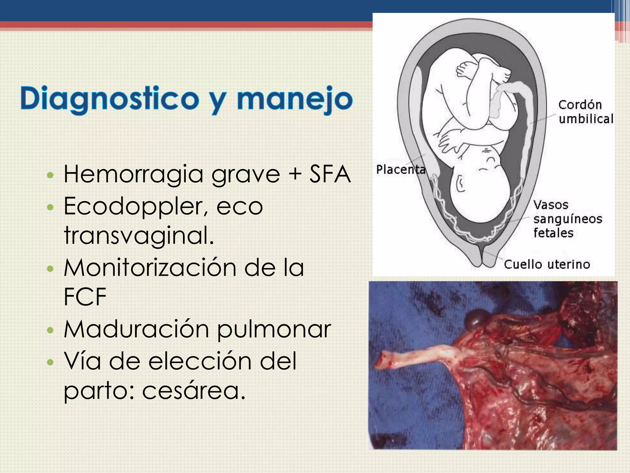 Placenta previa, vasa previa | PPTX