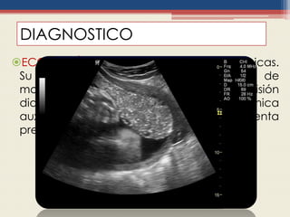 Placenta previa, vasa previa | PPTX