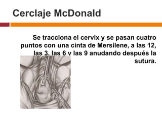 Placenta Previa - Cerclaje Cervical | PPTX