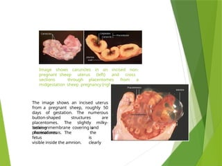 placenta , .pptx