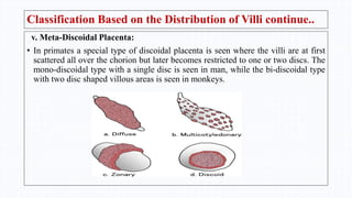 Discoid Placenta