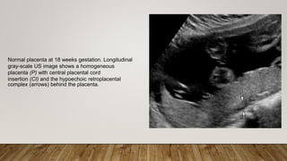 Placenta types and grading | PPTX