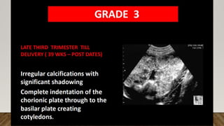 Placenta types and grading | PPTX