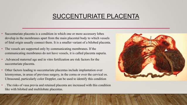 Placenta types and grading | PPTX | Pregnancy | Reproductive Health
