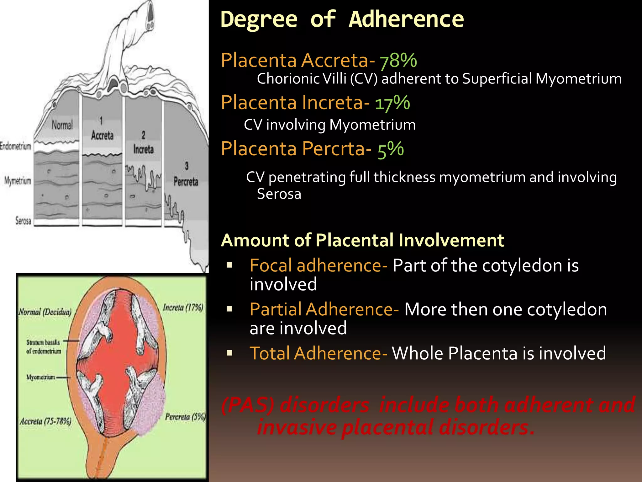 Placeta accreta syndrome | PPTX