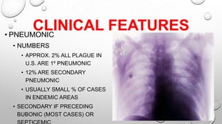Pneumonic Plague Pictures