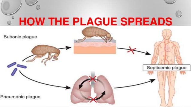 Plague