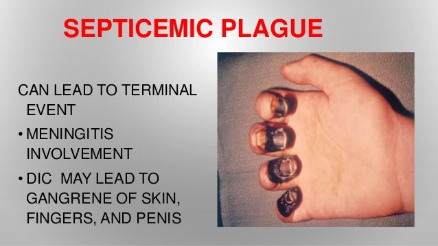 Plague