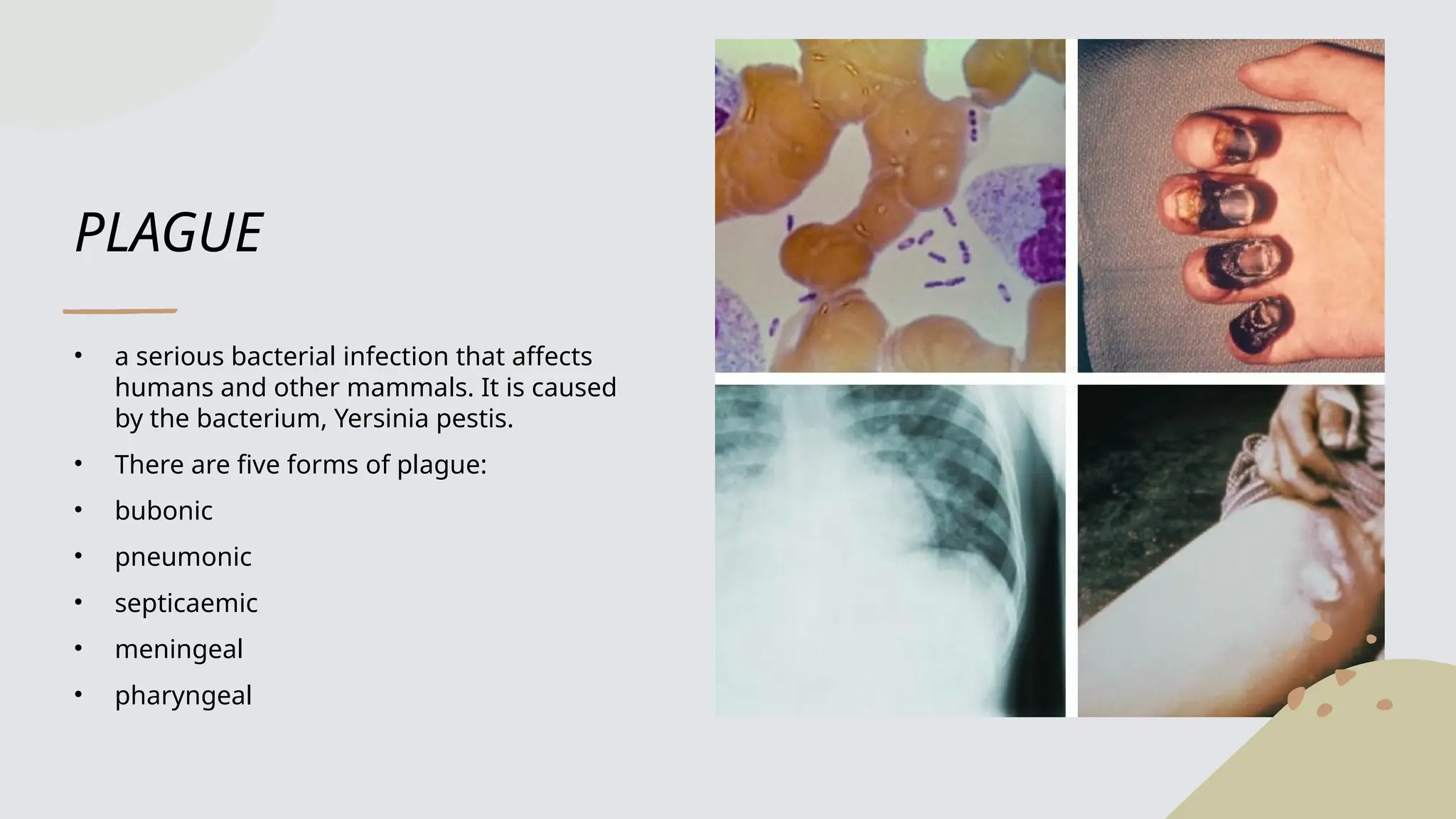 PLAGUE disease in infection disease pptx | PPTX