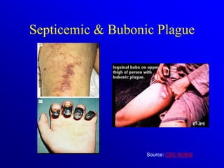 plague(1).ppt
