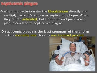 Plague disease | PPTX