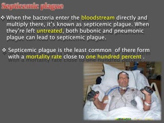Plague disease | PPTX