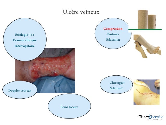 Plaies et cicatrisation : Apprendre à mieux soigner