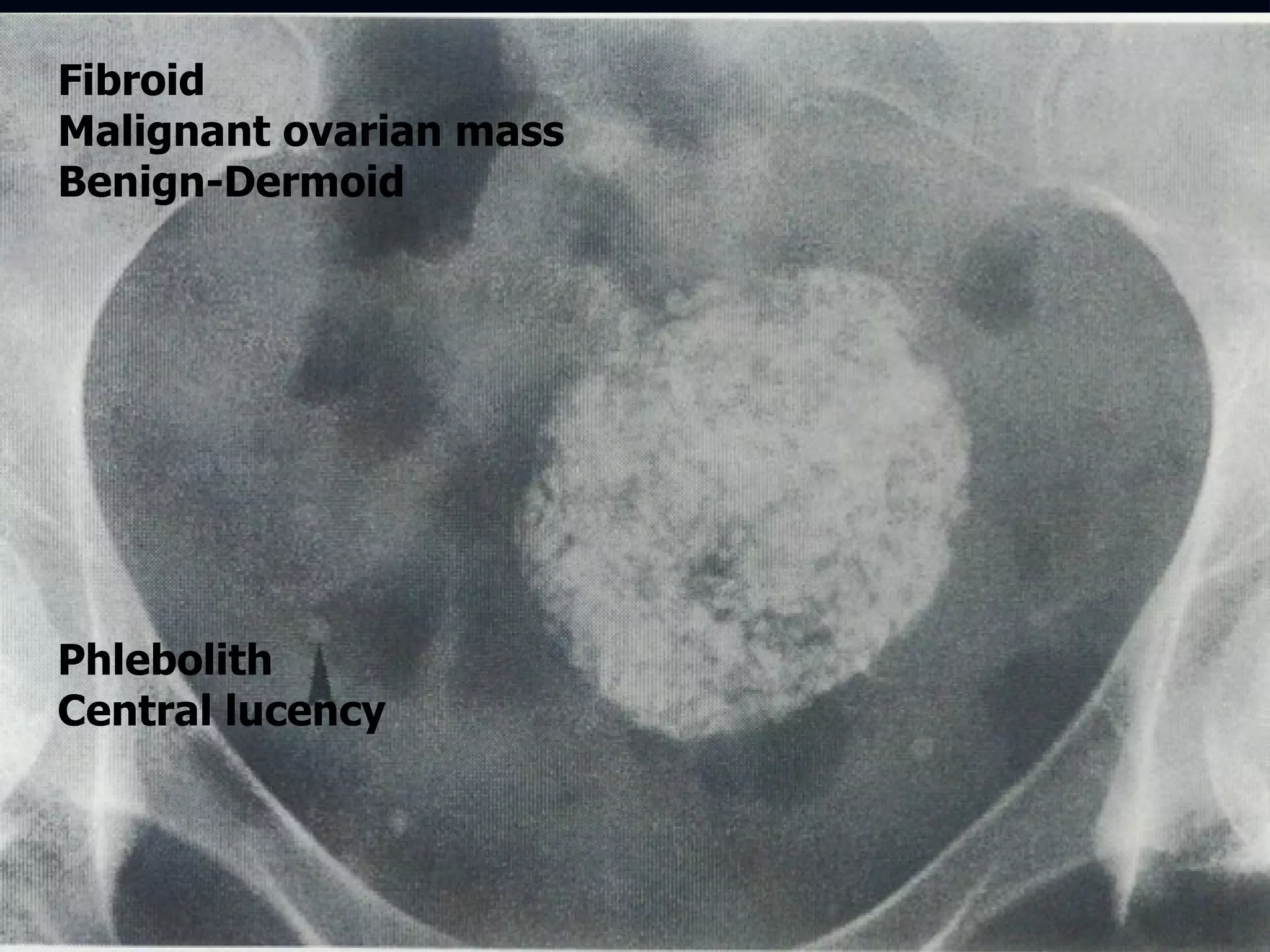 radiology.Plain abd.(dr.kawa) | PPT